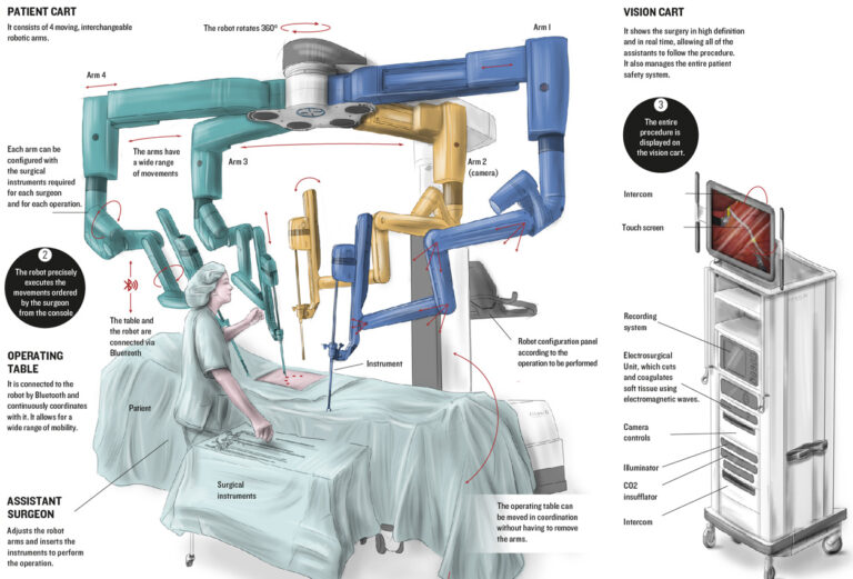 Robot-Assisted Surgery - IVO - Instituto Valenciano de Oncología